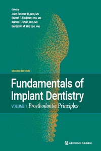 Fundamentals of Implant Dentistry, Volume 1: Prosthodontic Principles ...