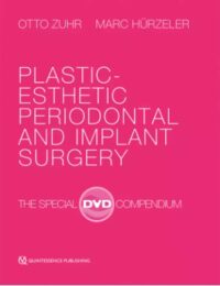 Plastic-Esthetic Periodontal and Implant Surgery: The Special DVD ...