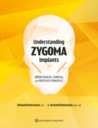 Understanding Zygoma Implants: Biomechanical, Surgical, and Prosthetic ...